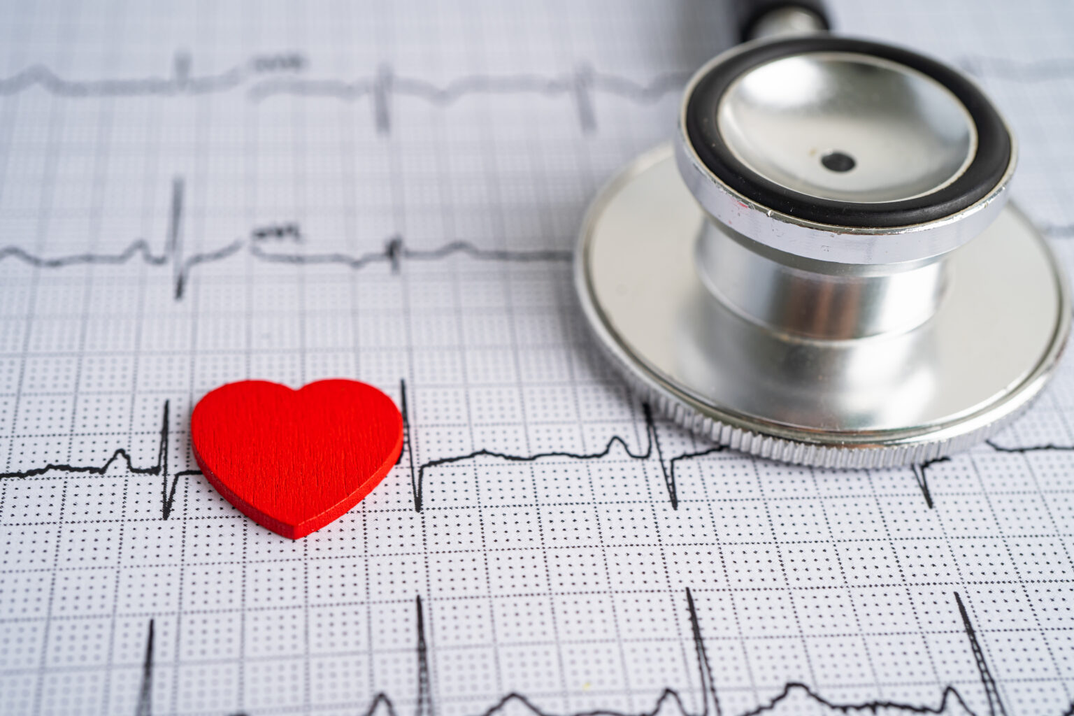 Alpha‑Lipoic Acid Supplement: Effect on Vascular Function and ...